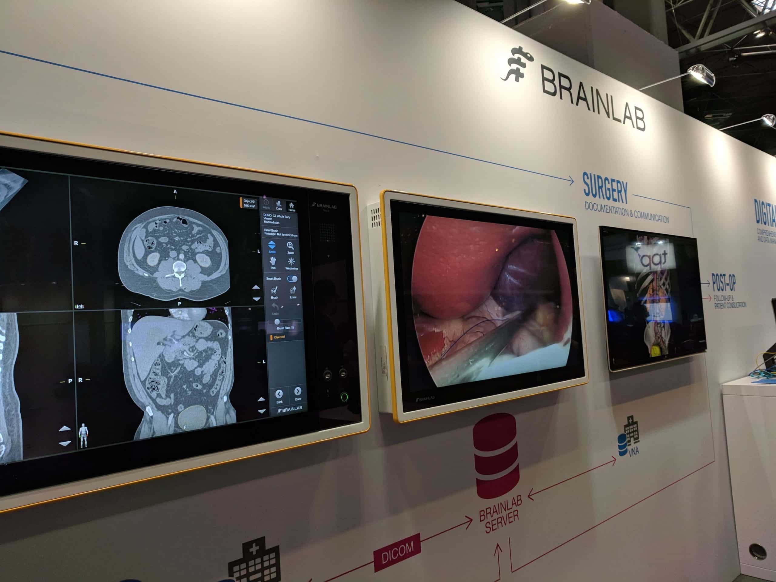 Health technology round up at EHI Live 2017